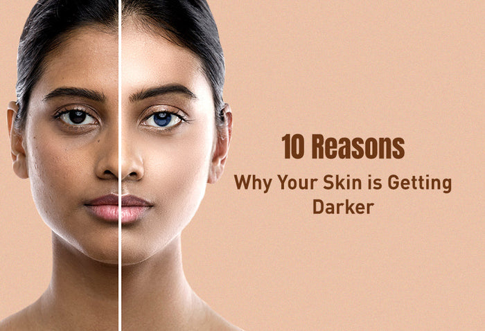 10 Reasons Why Your Skin is Getting Darker Day by Day – skeyndor